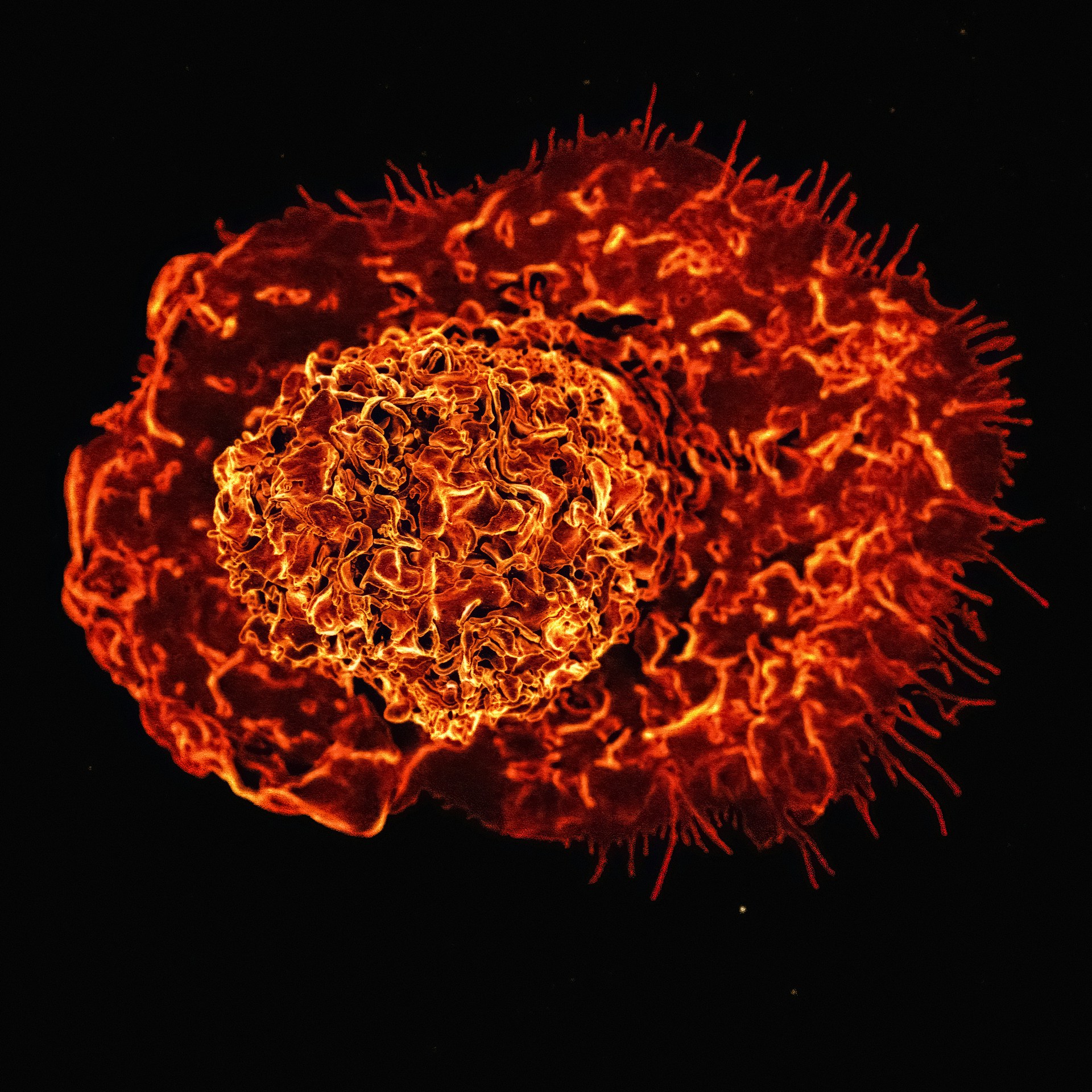 The Immune System And Heart Disease - Immunology Explained